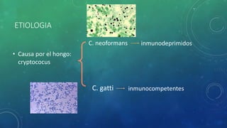 CRIPTOCOCOSIS CEREBRAL------------ .pptx