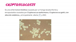 CRIPTOCOCOSIS grupo 1.pptx