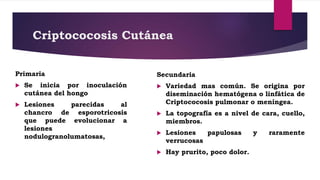 Criptococosis (micosis oportunista) | PPTX