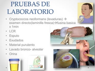 Cryptococcus | PPTX