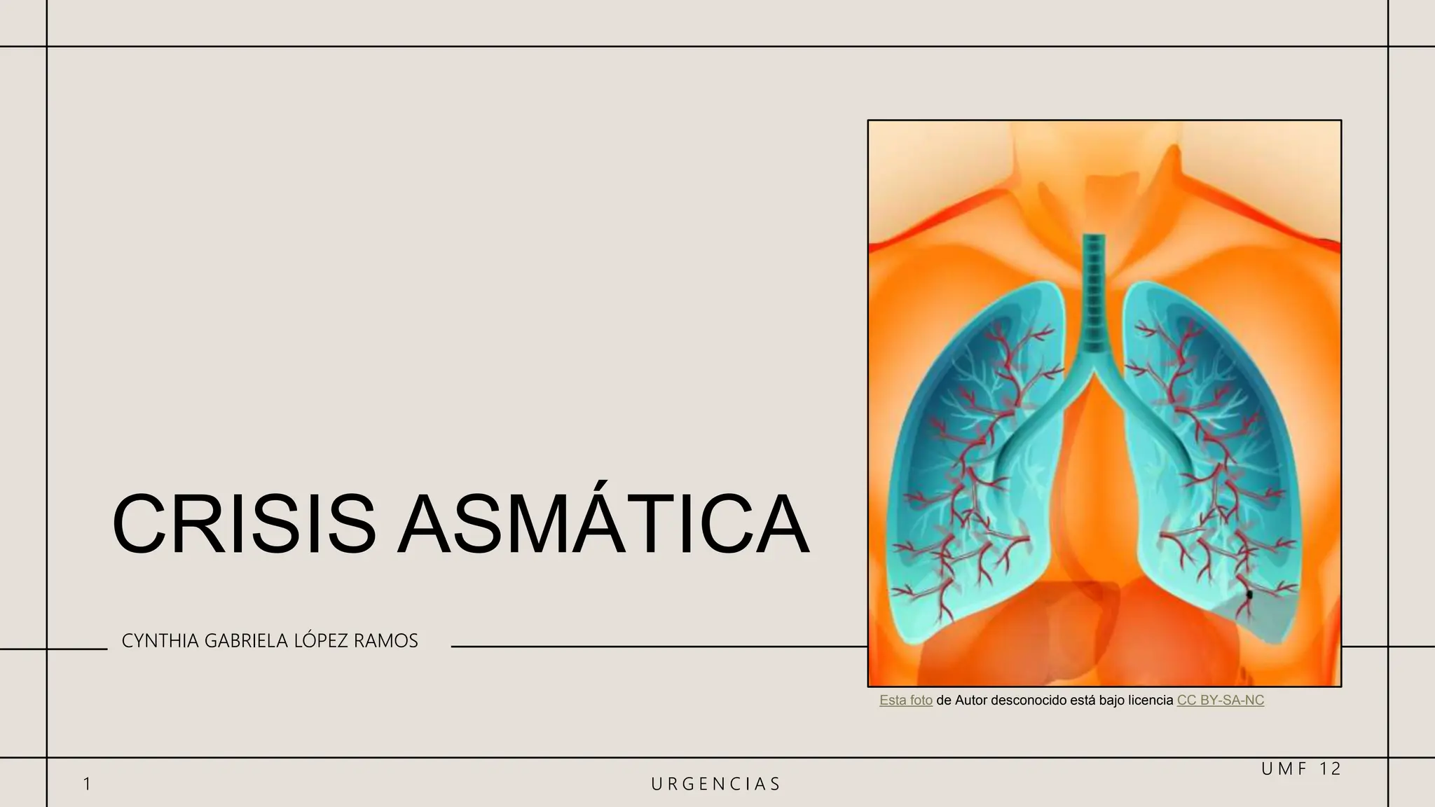 Asma y Crisis asmática gina y guia gema.pptx