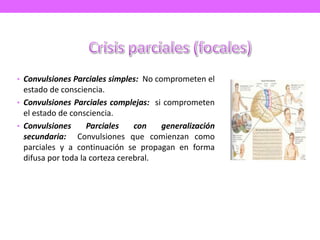 Crisis convulsivas y epilepsia | PPTX