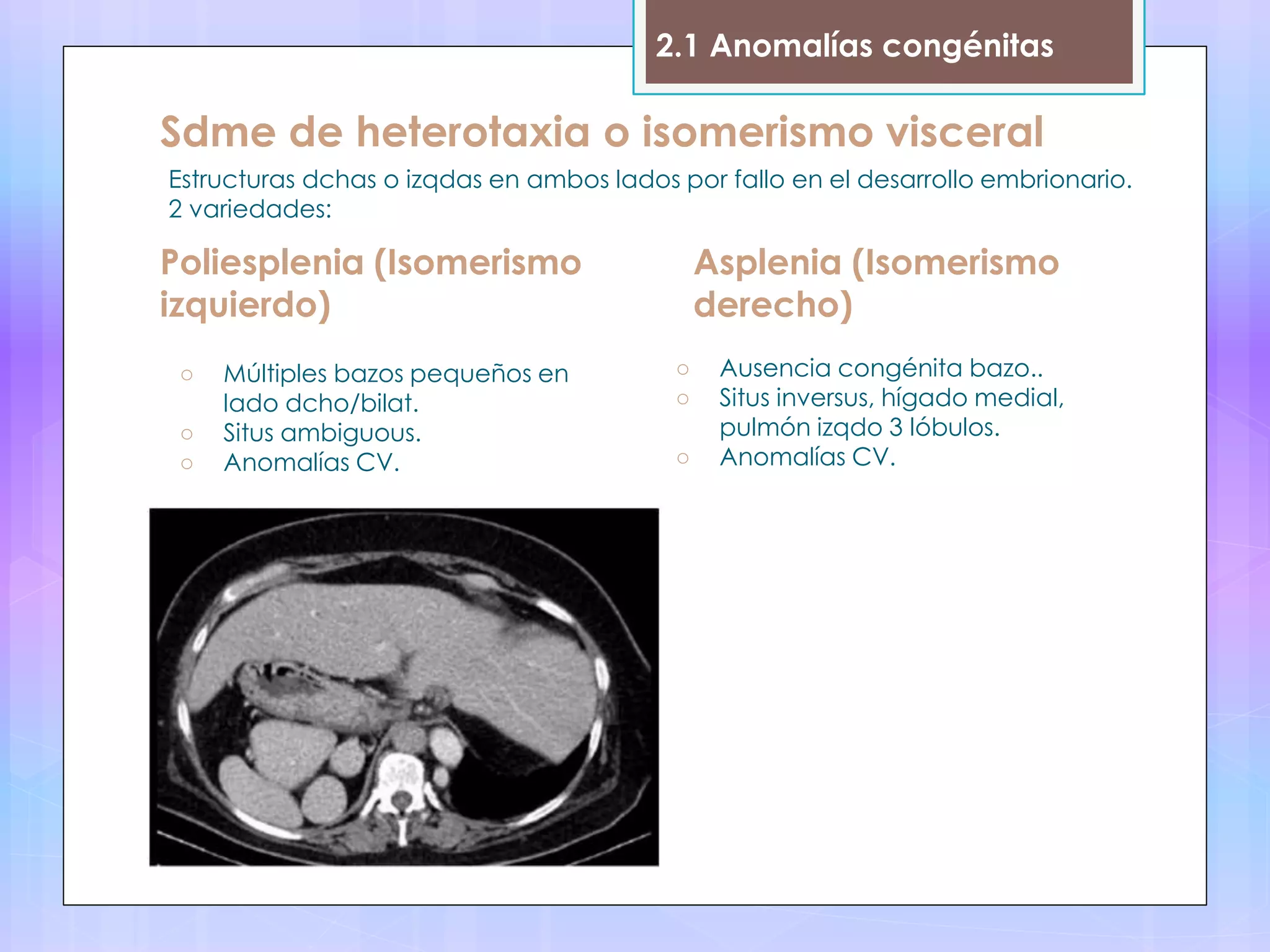 Lesiones focales esplenicas | PPTX