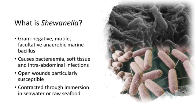 Reversal of carbapenem-resistance in Shewanella algae by CRISPR/Cas9 ...