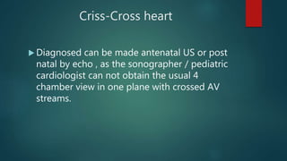 Criss cross , Veno-venous collaterals , TGA | PPTX