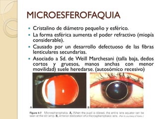 Cristalino anatomia y fisiologia | PDF