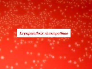 Erysipelothrix On Chocolate Agar