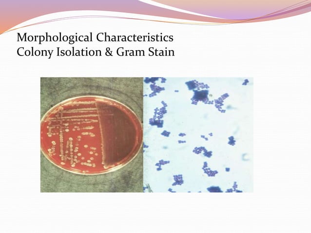 Criteria for classification of microbes | PPTX | Biological Sciences ...
