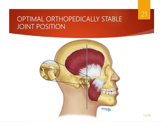 Criteria for optimum functional occlusion