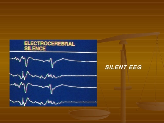 Criteria of Brain Death