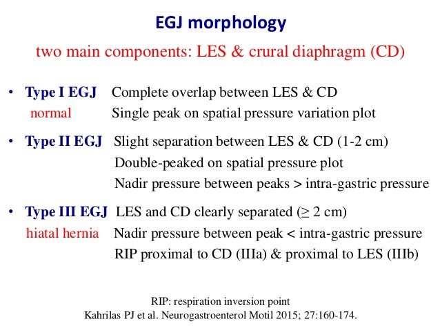 Normal & abnormal swallows in chicago classification version 3.0