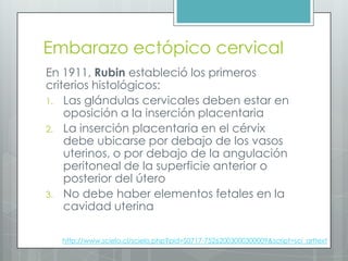 Criterios diagnostico para embarazo ectópico | PPTX