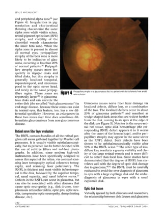 Criterios diagnosticos en glaucoma | PDF