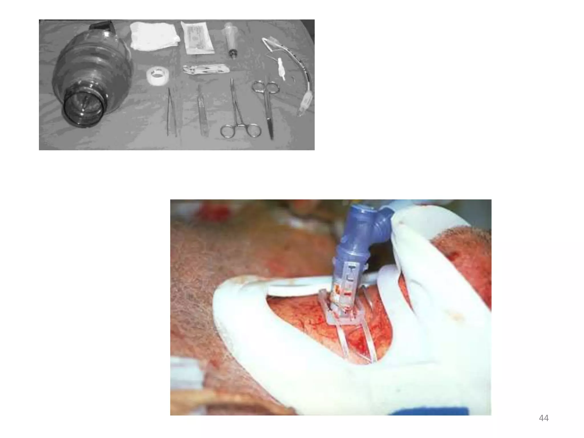 Critical care in burns patients | PPTX