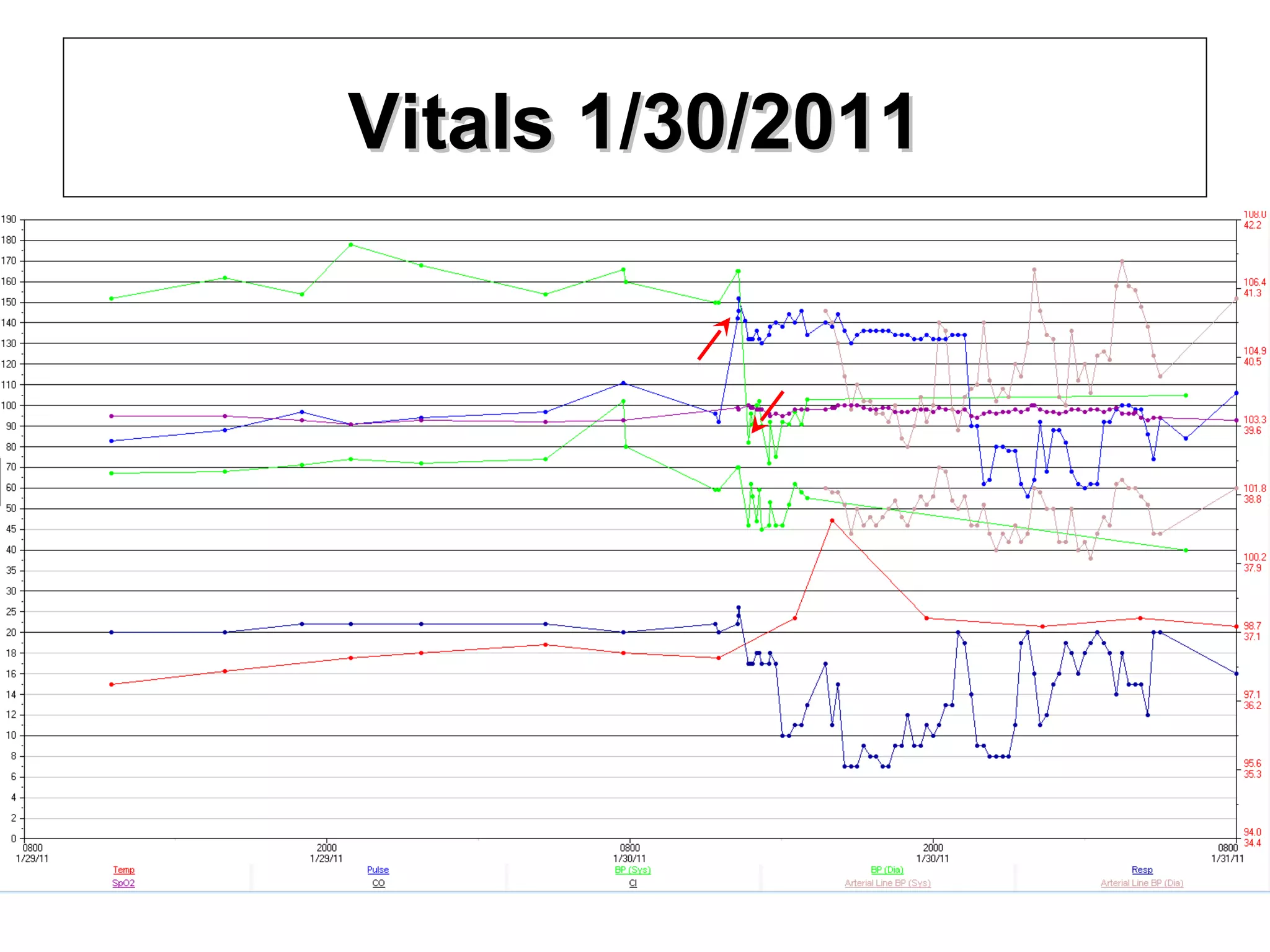 Systolic anterior motion of mitral valve - SAM | PPT | Heart and ...