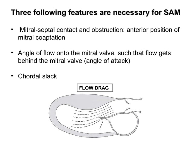 Systolic anterior motion of mitral valve - SAM | PPT | Heart and ...