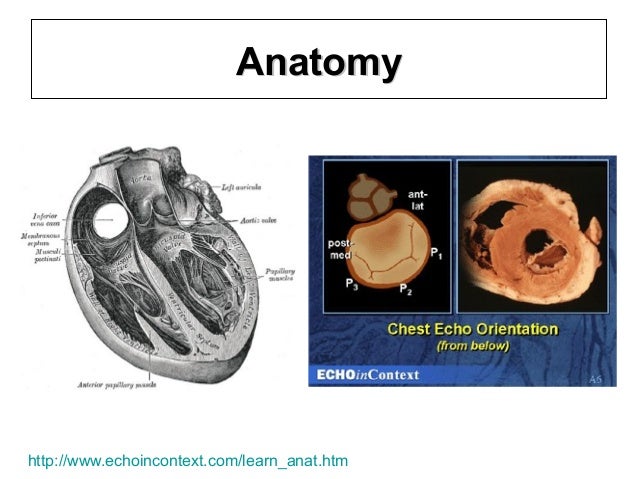 Systolic anterior motion of mitral valve - SAM