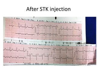 Critical case presentation1 | PPTX | Heart and Cardiovascular Diseases ...