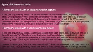 Critical congenital heart diseases | PPTX