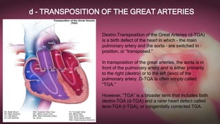Critical congenital heart diseases | PPTX