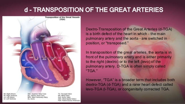 Critical congenital heart diseases