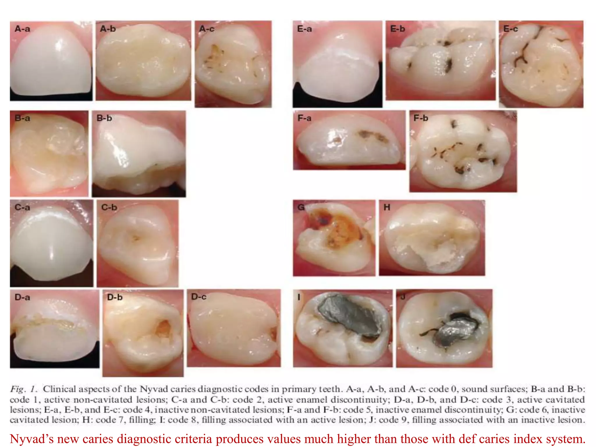 Critical evaluation of dental indices | PPTX