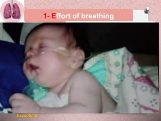 Critical ill infant and child.how to mange pptx | PPTX