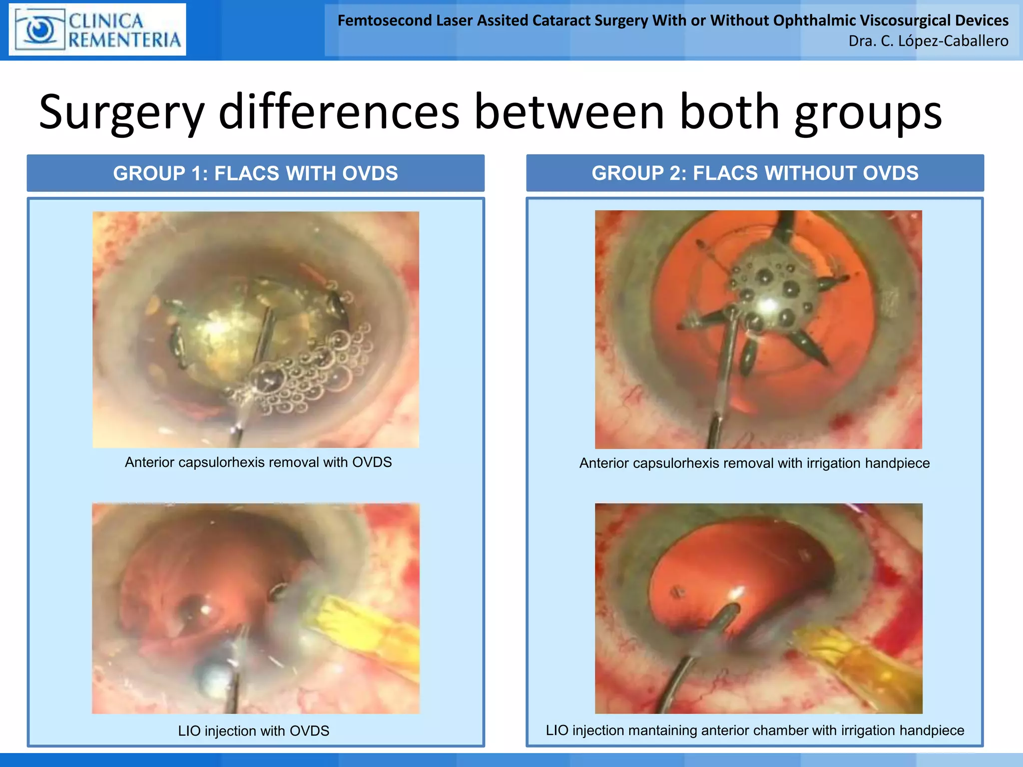 ESCRS14 - Femtosecond Laser Assisted Cataract Surgery With or Without ...