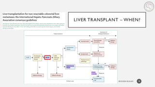 CRLM Liver full presentation detailed.pptx