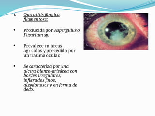 CÓRNEA Queratitis-2 ABORDAJE Y TRATAMIENTO .pptx
