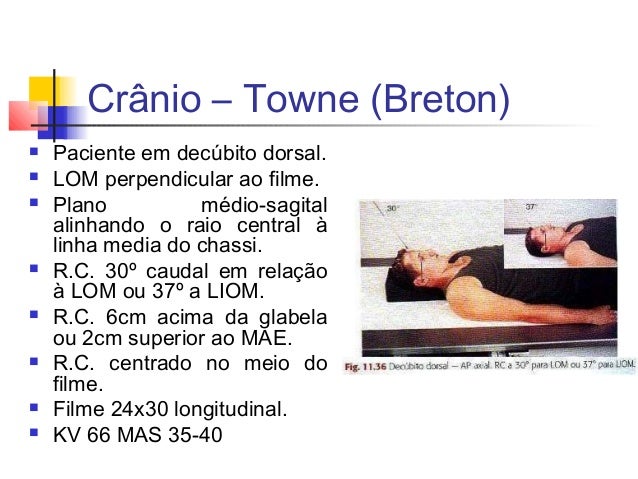 Crânio,saf,sela,mandibula,atm