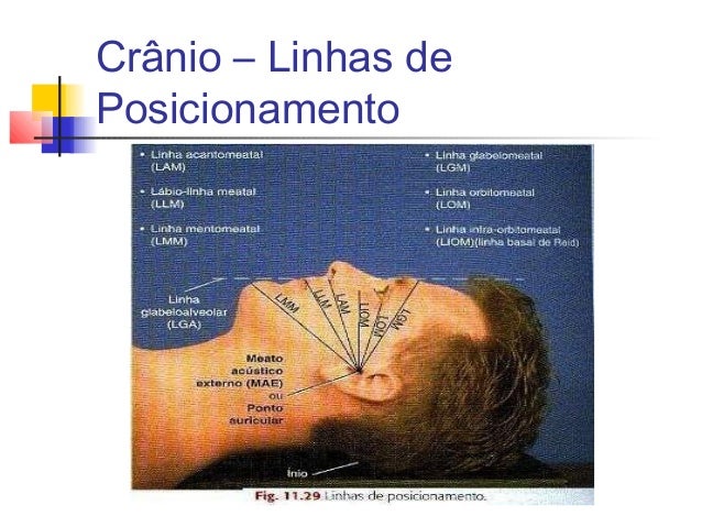 Crânio,saf,sela,mandibula,atm