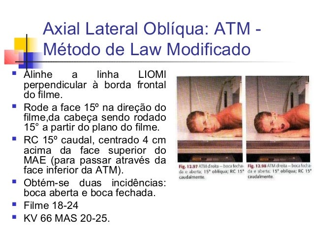 Crânio,saf,sela,mandibula,atm