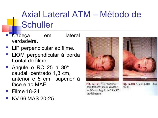 Crânio,saf,sela,mandibula,atm