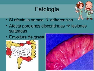 Enfermedad Intestinal Inflamatoria (CUCI Y CROHN) | PPT