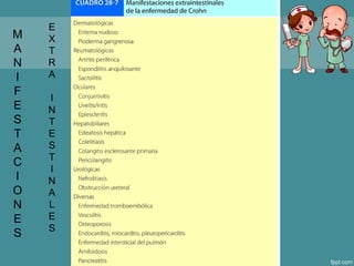 Enfermedad Intestinal Inflamatoria (CUCI Y CROHN) | PPT
