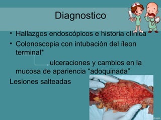 Enfermedad Intestinal Inflamatoria (CUCI Y CROHN) | PPT