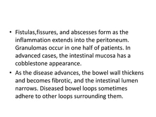 crohns.pptx MED SURGICAL NURSING BY JEPHTERS | PPT
