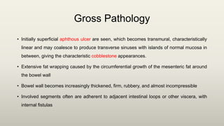 Crohn's diseases topic of general surgery | PPTX