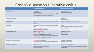 Crohn's diseases topic of general surgery | PPTX