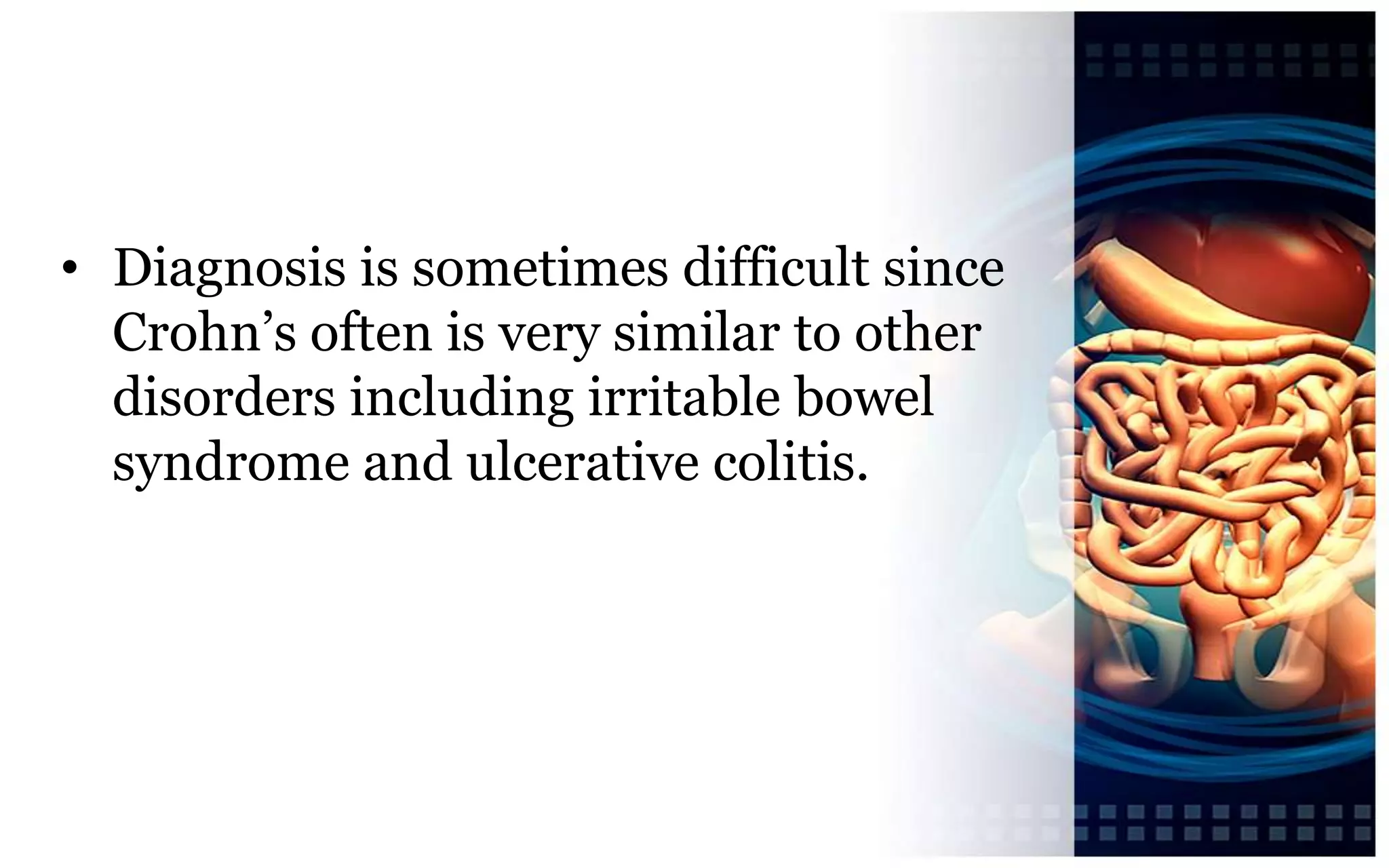 Crohns Disease Ppt