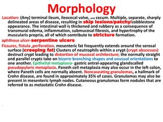 Crohn's disease signs,symptoms,Morphology | PPTX