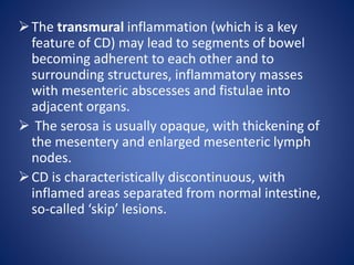 Crohns disease | PPTX