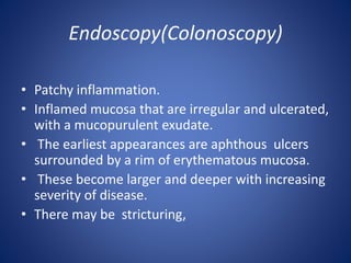 Crohns disease | PPTX