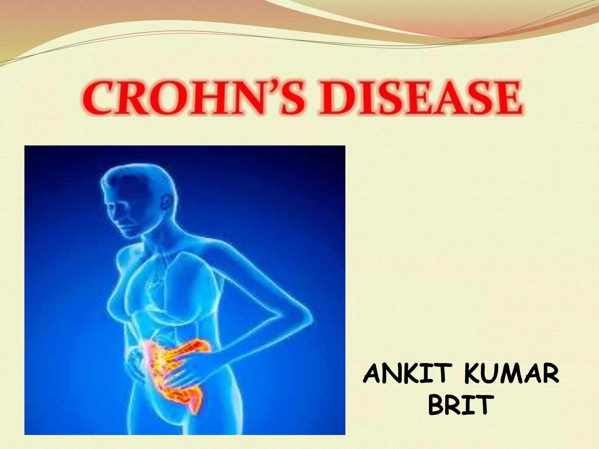 Crohns Disease Ppt