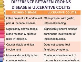CROHNS DISEASE | PPT