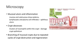 CROHN’S DISEASE.pptx