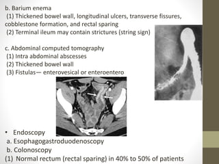 Crohn’s Disease | PPTX
