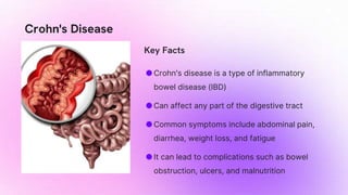 Crohn's Disease.pptx