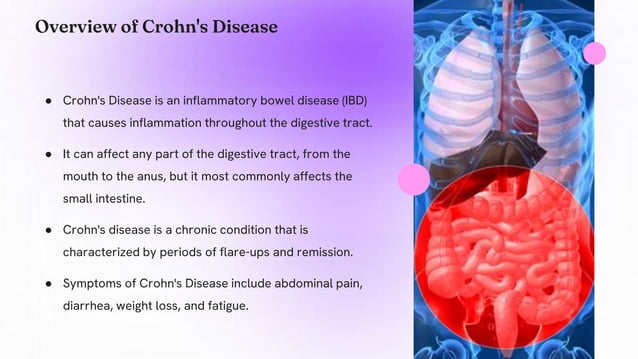 Crohns Diseasepptx